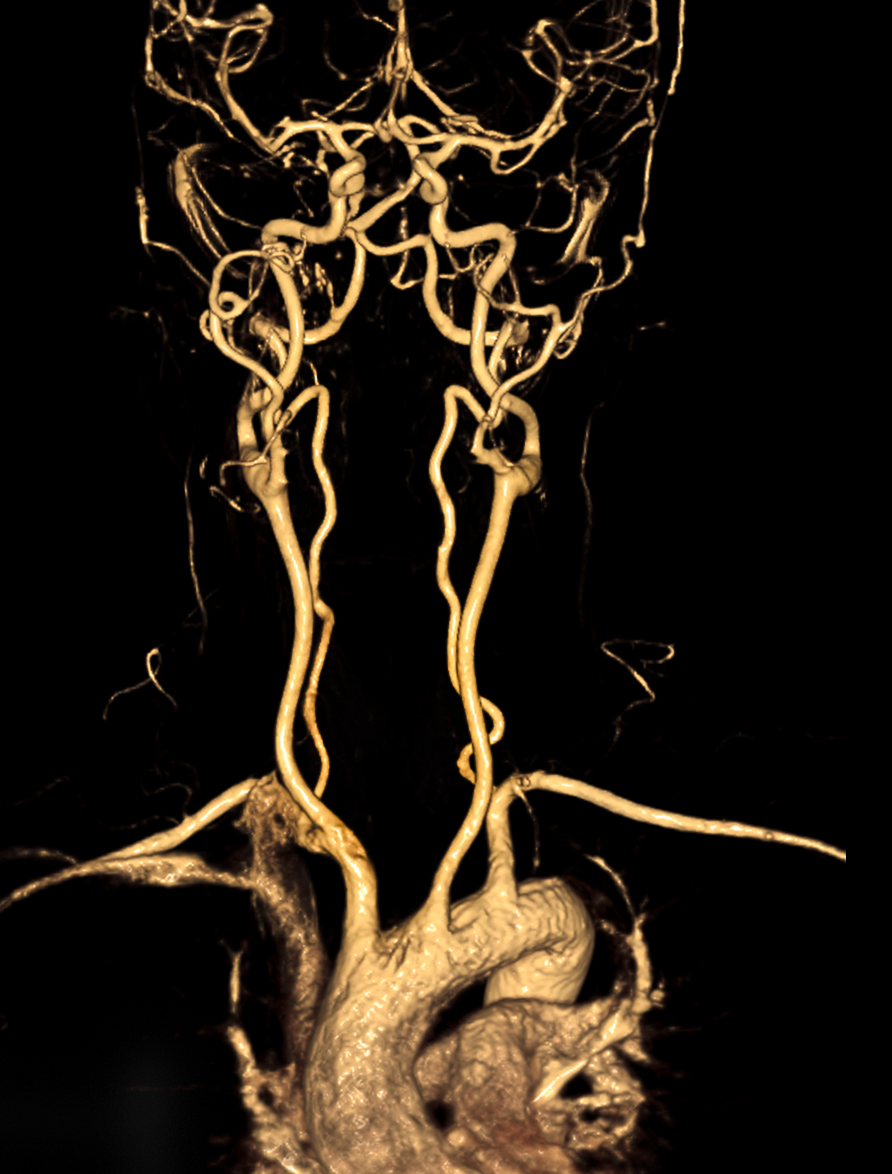 MFilms - HD Color Prints of MRI and CT