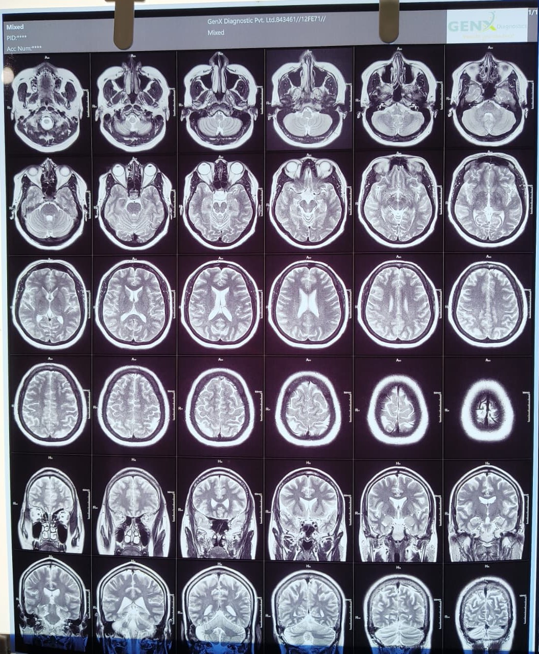 MFilms - HD Color Prints of MRI and CT