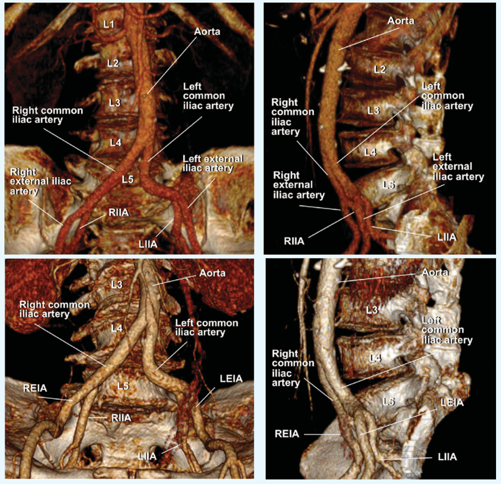 MFilms - HD Color Prints of MRI and CT