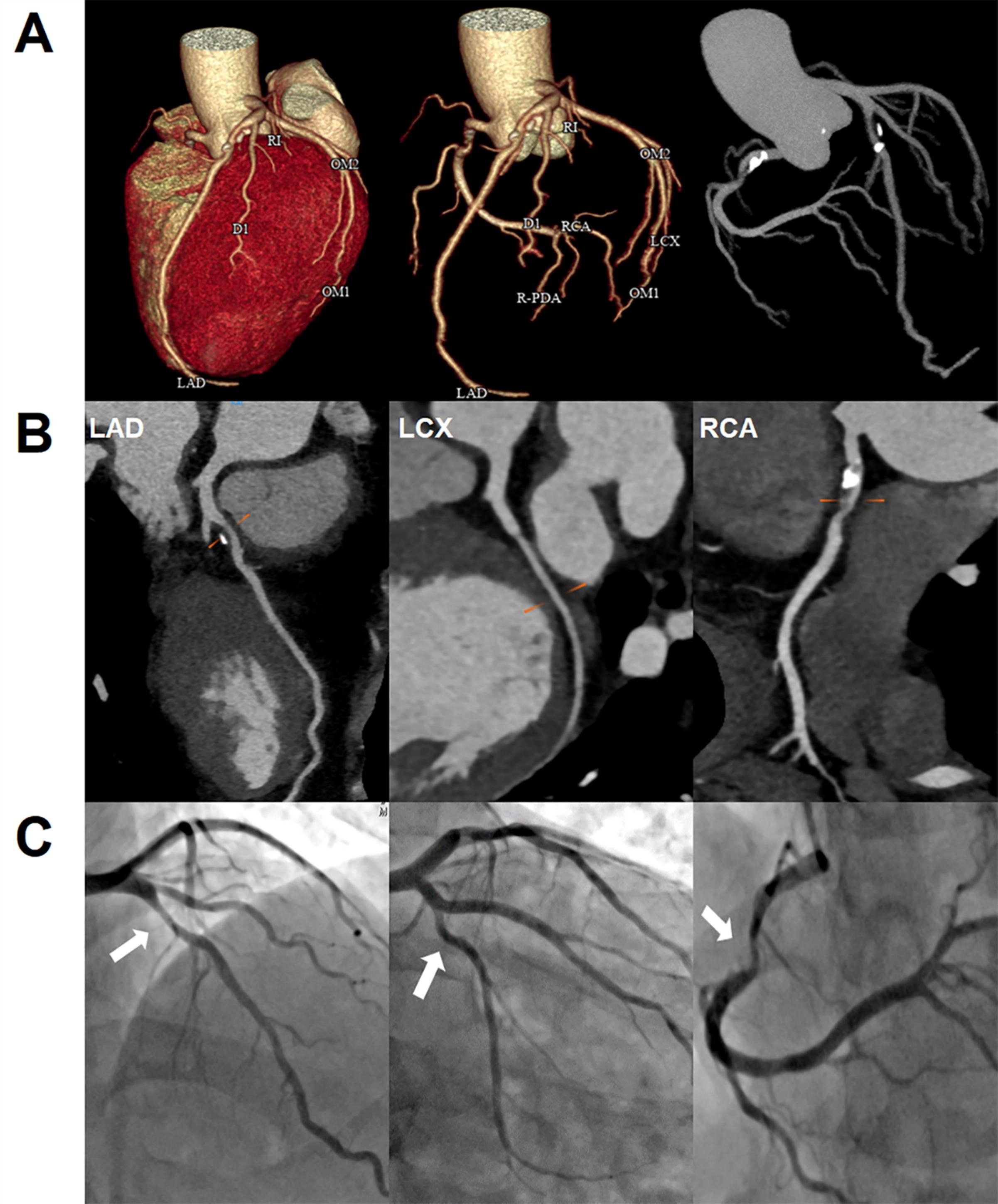 MFilms - HD Color Prints of MRI and CT