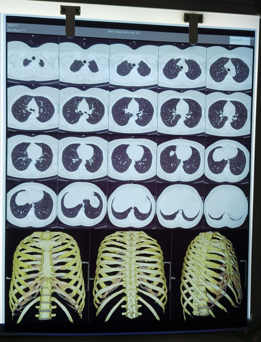 MFilms - HD Color Prints of MRI and CT