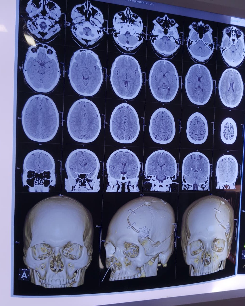 MFilms - HD Color Prints of MRI and CT