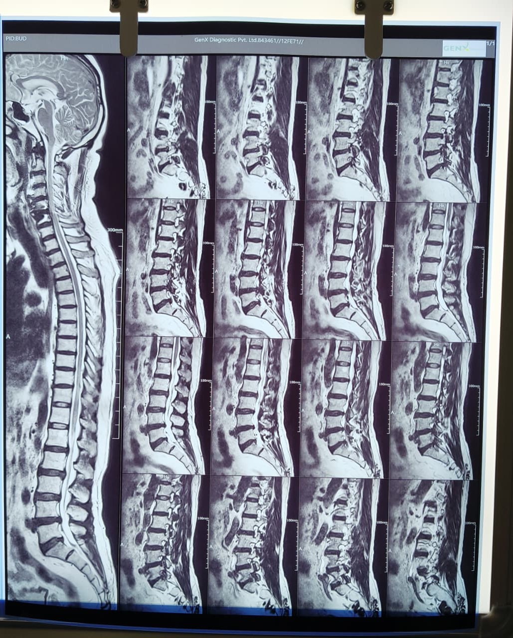 MFilms - HD Color Prints of MRI and CT